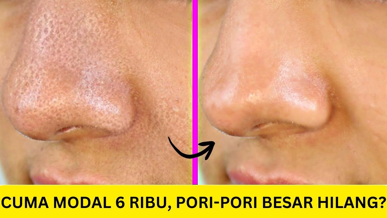 Mulai 6 Ribuan! 5 Produk Mengecilkan Pori-pori Wajah Agar Terlihat Mulus yang Asli Ampuhnya ...
