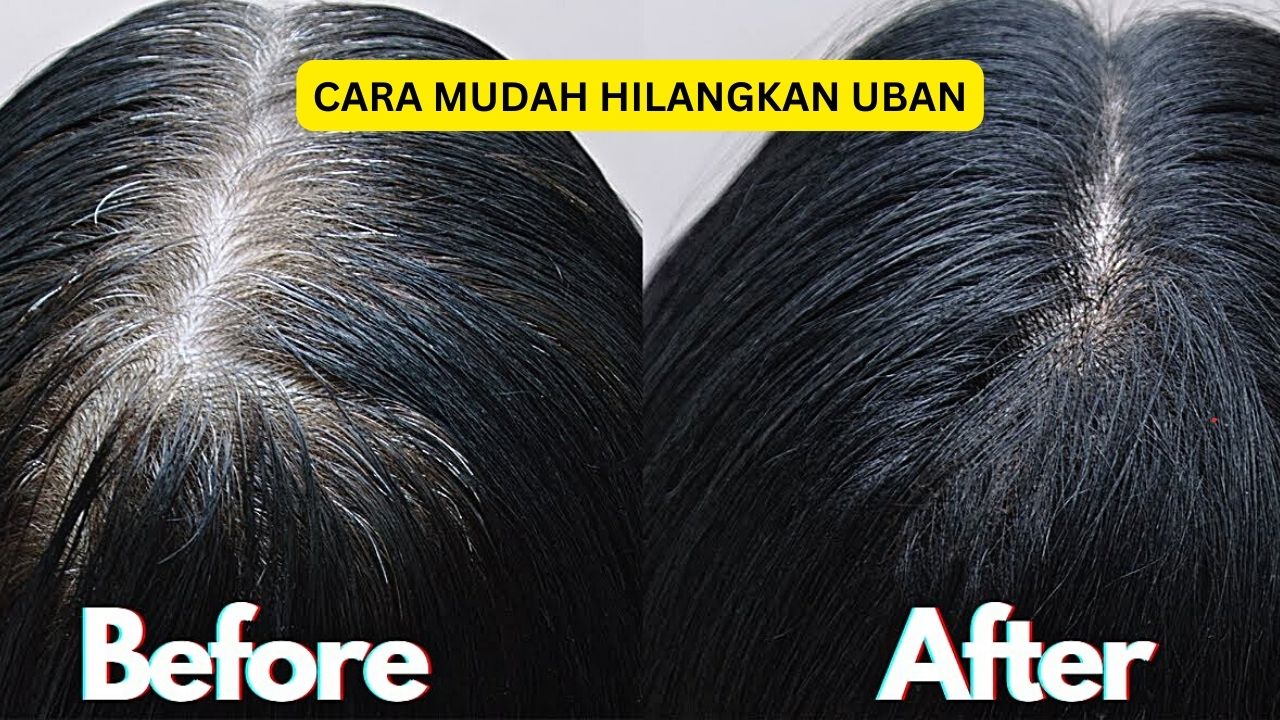 Asli Tanpa Cat Rambut! Ini 5 Cara Menghilangkan Uban Secara Alami Tanpa Modal, Semua Bahan Ada ...