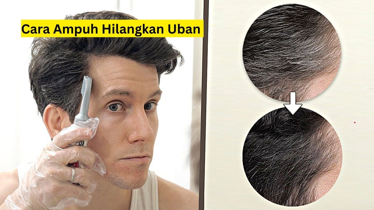 Gak Perlu Cat Rambut! 5 Cara Menghilangkan Uban di Usia Muda yang Alami dan Hasil Permanen dalam ...