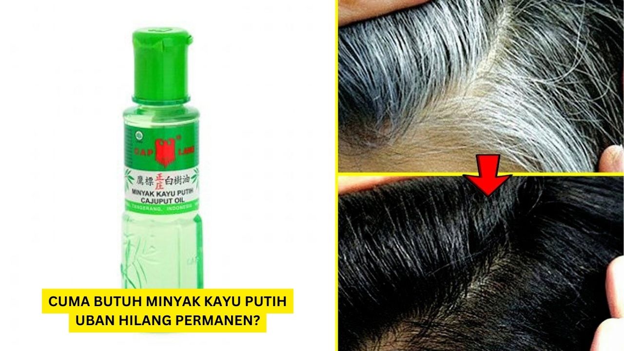 Sejak Tahu 3 Cara Menghilangkan Uban dengan Minyak Kayu Putih Ini ...