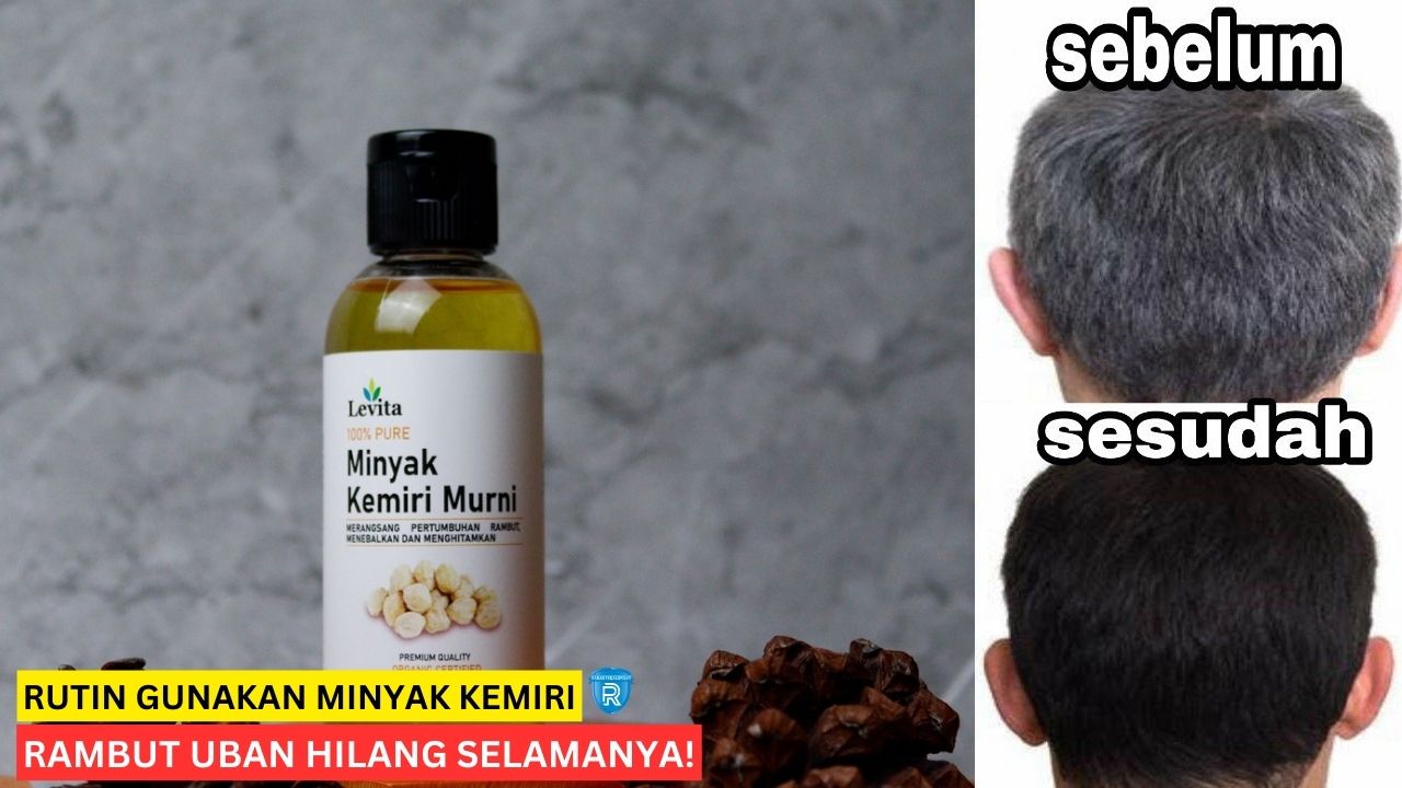 Bagaimana Cara Pakai Minyak Kemiri untuk Rambut Beruban? Ini 3 Tips ...