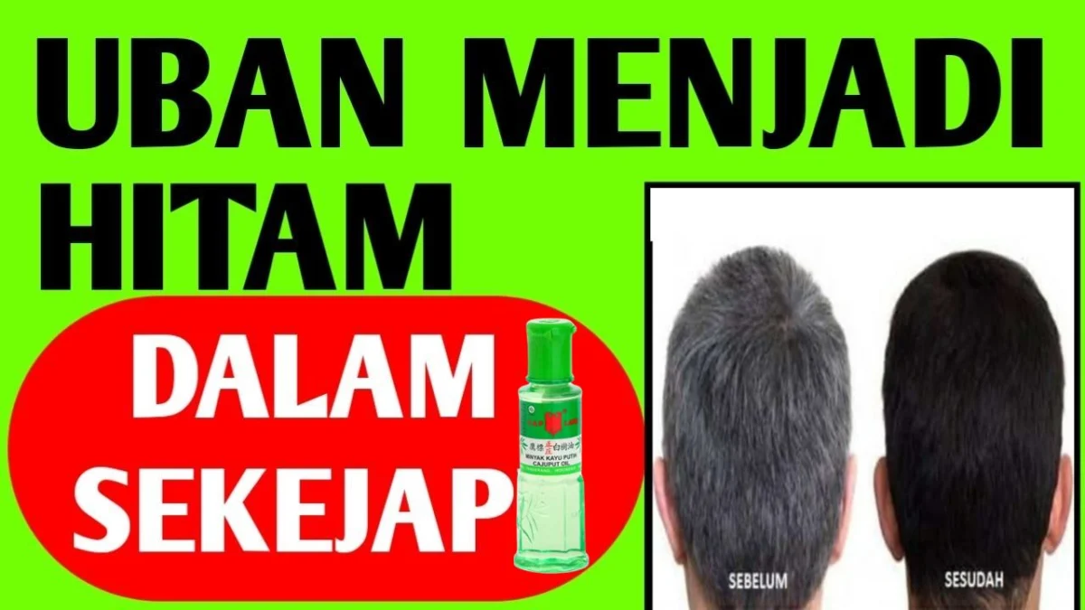 Mau Uban Langsung Hilang? Ini 5 Manfaat Minyak Kayu Putih untuk Rambut, Modal Gratisan, Cuma ...