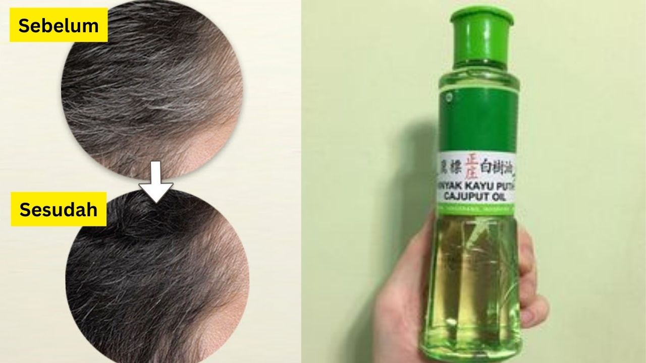 Manjur Hitamkan Uban dengan Cepat! 5 Manfaat Minyak Kayu Putih Cap Lang untuk Rambut yang Jarang ...