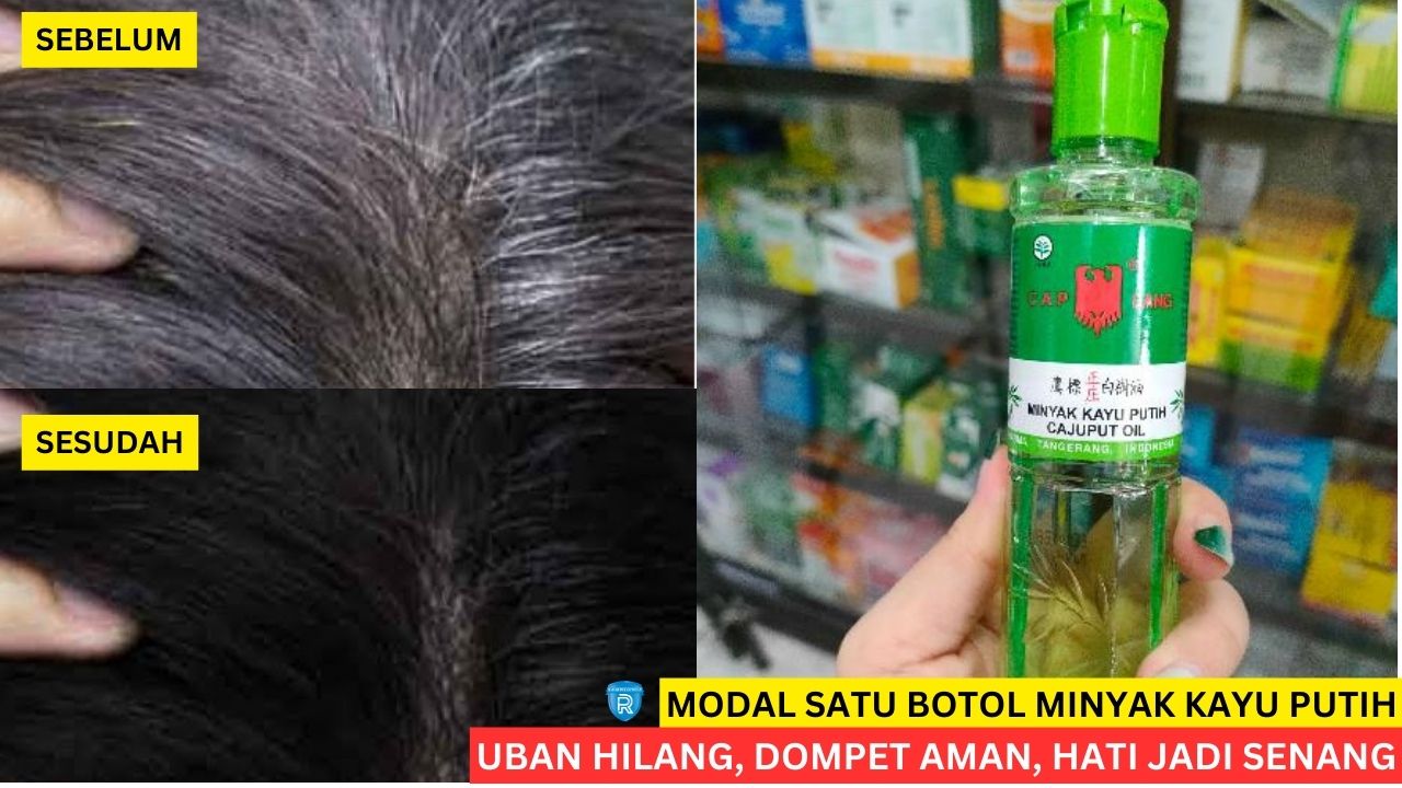 Bagaimana Cara Menghilangkan Uban dengan Minyak Kayu Putih? Ternyata, Ini 3 Tips Manjur Bikin ...