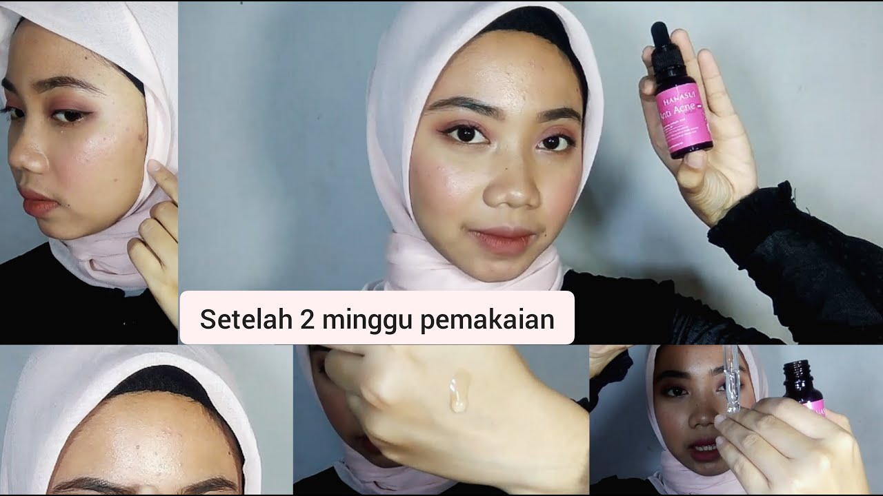 Cuma 20 Ribuan Bisa Hilangkan Jerawat? Inilah Manfaat Serum Hanasui ...