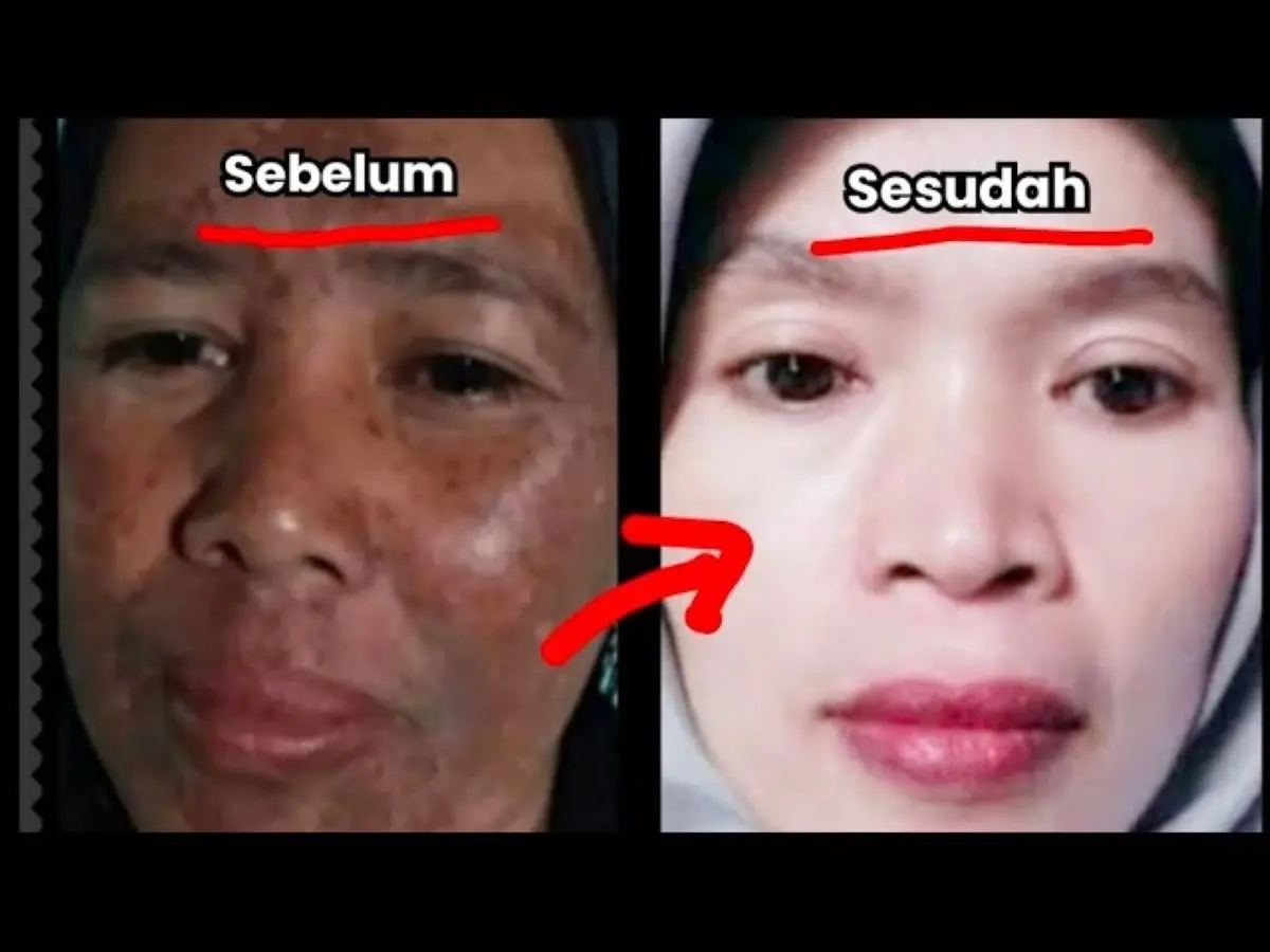 3 Cara Memutihkan Wajah Dengan Jeruk Nipis Dengan Cepat, Ini Tips Aman Menggunakannya! – Radar ...