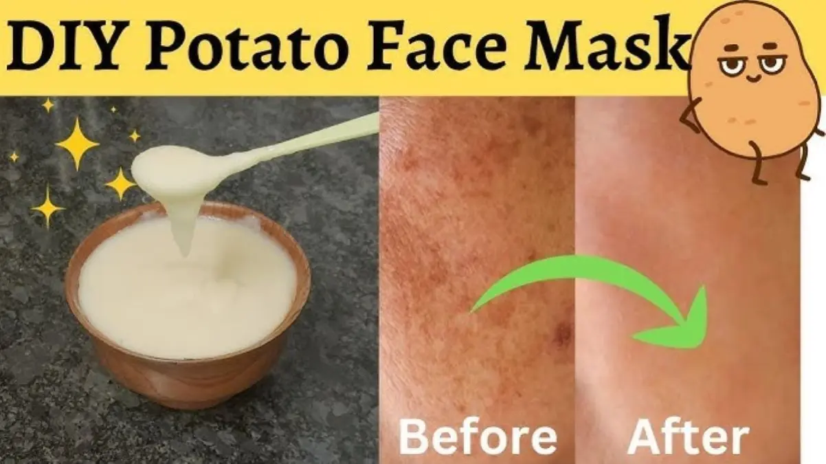 Ternyata, Begini Cara Bikin Masker Kentang untuk Menghilangkan Flek Hitam dalam 4 Langkah ...